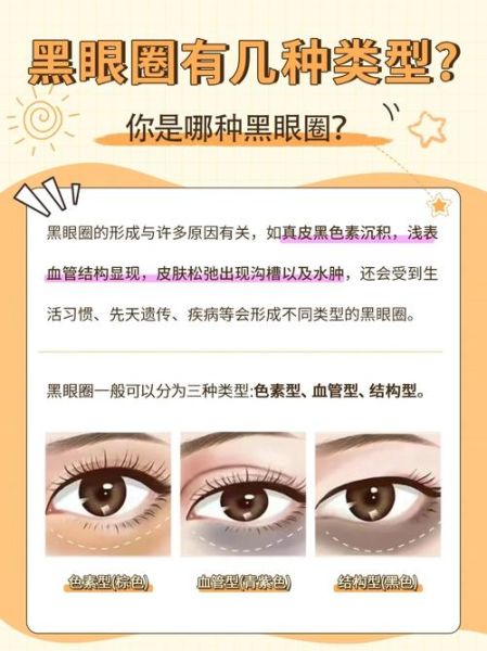 黑眼圈怎么消除最快_去黑眼圈最有效的方法-第1张图片-山城妙识 黑眼圈怎么消除最快_去黑眼圈最有效的方法-第1张图片-山城妙识