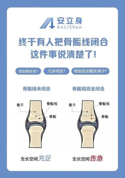 自测骨骼闭合小方法_骨骺线是否闭合怎么判断-第3张图片-山城妙识 自测骨骼闭合小方法_骨骺线是否闭合怎么判断-第3张图片-山城妙识