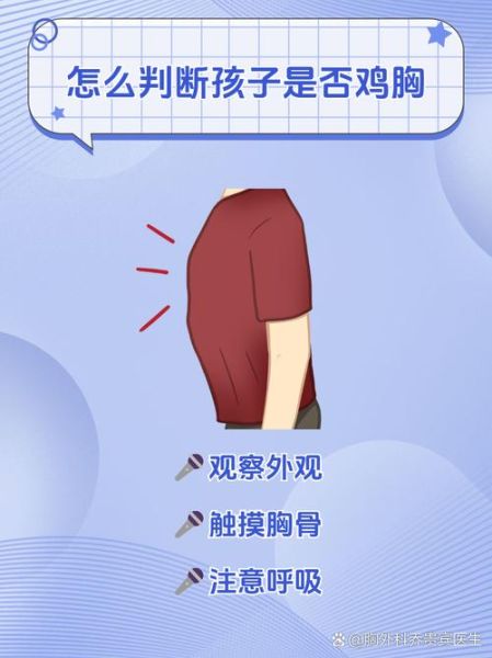 鸡胸和正常人胸部对比图_鸡胸矫正方法有哪些-第1张图片-山城妙识 鸡胸和正常人胸部对比图_鸡胸矫正方法有哪些-第1张图片-山城妙识