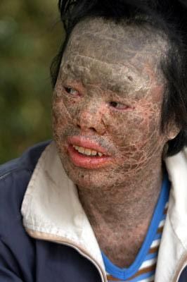 莲蓬乳图片_为什么会让人恐惧-第2张图片-山城妙识 莲蓬乳图片_为什么会让人恐惧-第2张图片-山城妙识