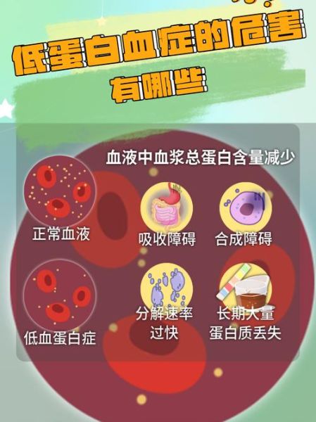 人体每天需要多少蛋白质_蛋白质不足有哪些表现-第3张图片-山城妙识 人体每天需要多少蛋白质_蛋白质不足有哪些表现-第3张图片-山城妙识