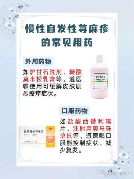 荨麻疹吃什么药好_荨麻疹止痒最快的方法-第2张图片-山城妙识 荨麻疹吃什么药好_荨麻疹止痒最快的方法-第2张图片-山城妙识