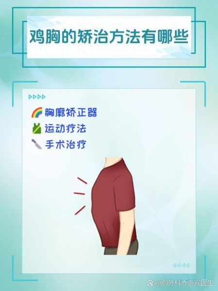 女性鸡胸病怎么矫正_鸡胸病图片特征-第1张图片-山城妙识 女性鸡胸病怎么矫正_鸡胸病图片特征-第1张图片-山城妙识