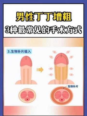 如何壮阳增加长度_男人增大增粗真的有效吗-第2张图片-山城妙识 如何壮阳增加长度_男人增大增粗真的有效吗-第2张图片-山城妙识