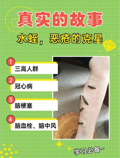 水蛭的功效与作用_水蛭能治疗哪些疾病-第1张图片-山城妙识 水蛭的功效与作用_水蛭能治疗哪些疾病-第1张图片-山城妙识