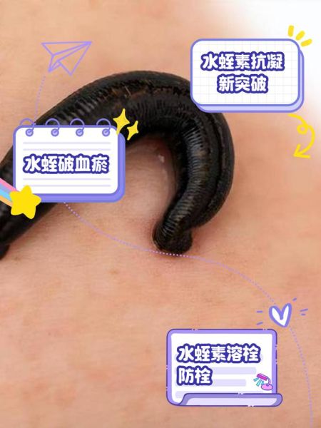 水蛭的功效与作用_水蛭能治疗哪些疾病-第3张图片-山城妙识 水蛭的功效与作用_水蛭能治疗哪些疾病-第3张图片-山城妙识