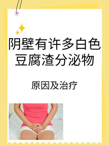 白带豆腐渣状不痒不臭_需要治疗吗-第1张图片-山城妙识 白带豆腐渣状不痒不臭_需要治疗吗-第1张图片-山城妙识