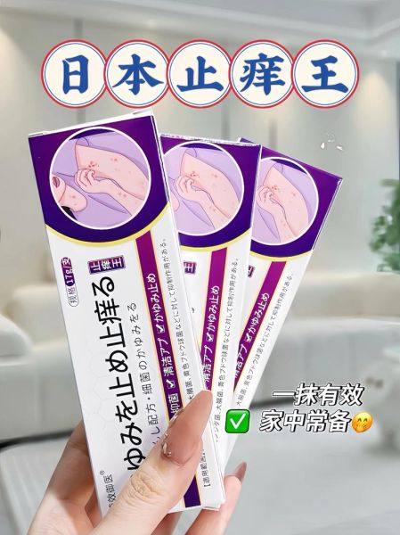 芋艿手痒怎么办_止痒最快方法-第2张图片-山城妙识 芋艿手痒怎么办_止痒最快方法-第2张图片-山城妙识