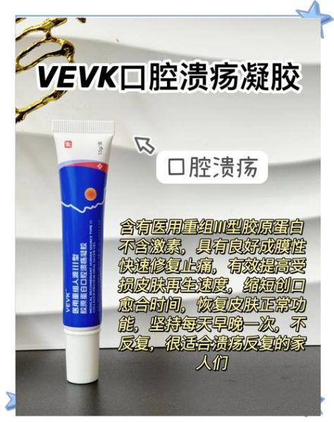 维生素b2治口腔溃疡多久见效_怎么吃最有效-第3张图片-山城妙识 维生素b2治口腔溃疡多久见效_怎么吃最有效-第3张图片-山城妙识