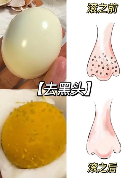 蛋清去黑头后会更严重吗_蛋清去黑头为什么越用越糟-第1张图片-山城妙识