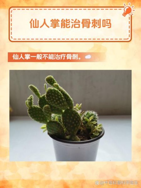 仙人掌去眼袋的小偏方_仙人掌去眼袋有效吗-第1张图片-山城妙识 仙人掌去眼袋的小偏方_仙人掌去眼袋有效吗-第1张图片-山城妙识