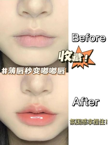 香肠嘴怎么变薄_嘴唇厚怎么自然变薄-第2张图片-山城妙识