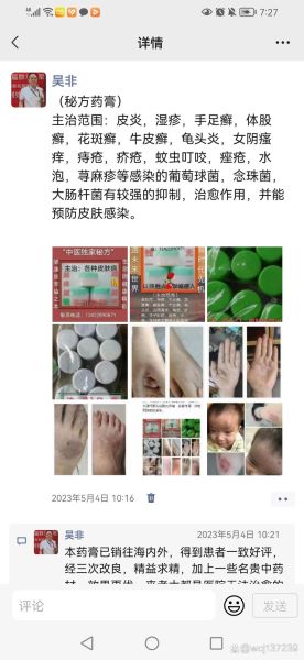 一招断根的皮肤病秘方_真的有效吗-第3张图片-山城妙识