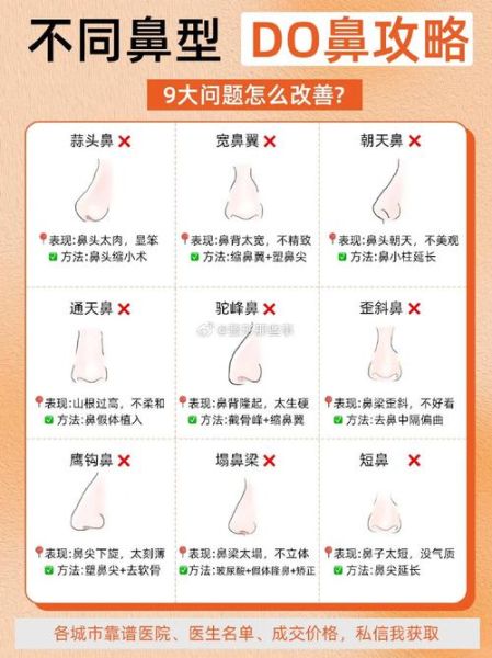 大蒜鼻图片_怎么改善大蒜鼻-第2张图片-山城妙识 大蒜鼻图片_怎么改善大蒜鼻-第2张图片-山城妙识