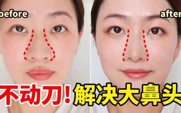 大蒜鼻怎么变小_大蒜鼻自然缩小的方法-第2张图片-山城妙识 大蒜鼻怎么变小_大蒜鼻自然缩小的方法-第2张图片-山城妙识