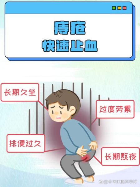 痔疮偏方真的有用吗_痔疮出血怎么快速止血-第2张图片-山城妙识 痔疮偏方真的有用吗_痔疮出血怎么快速止血-第2张图片-山城妙识