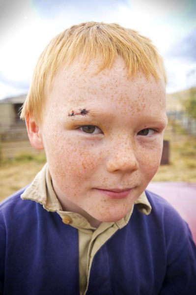 牛奶咖啡斑图片小孩_会自己消失吗-第1张图片-山城妙识 牛奶咖啡斑图片小孩_会自己消失吗-第1张图片-山城妙识