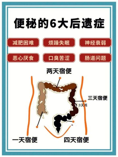 吃什么通大便最快_便秘吃什么立刻见效-第2张图片-山城妙识