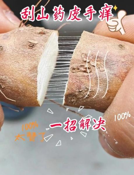 刮山药手痒怎么止痒_山药过敏最快缓解方法-第1张图片-山城妙识