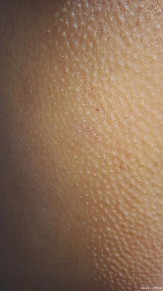 鸡皮疙瘩图片_为什么会起鸡皮疙瘩-第1张图片-山城妙识 鸡皮疙瘩图片_为什么会起鸡皮疙瘩-第1张图片-山城妙识