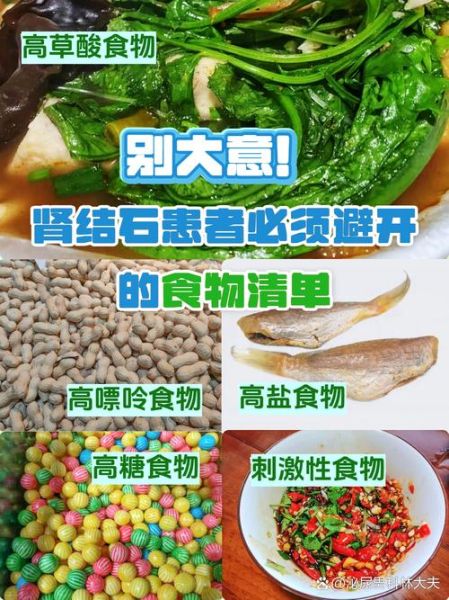肾结石最怕的六种食物_肾结石吃什么能排石-第1张图片-山城妙识 肾结石最怕的六种食物_肾结石吃什么能排石-第1张图片-山城妙识