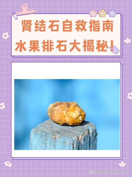 胆结石最怕三种水果_吃什么水果能排石-第3张图片-山城妙识