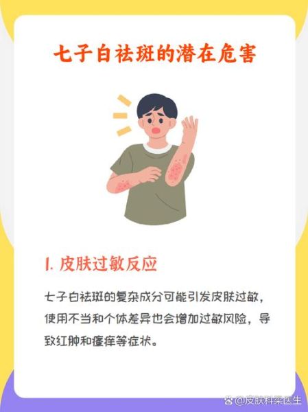 七子白祛斑的危害有哪些_七子白祛斑副作用大吗-第1张图片-山城妙识