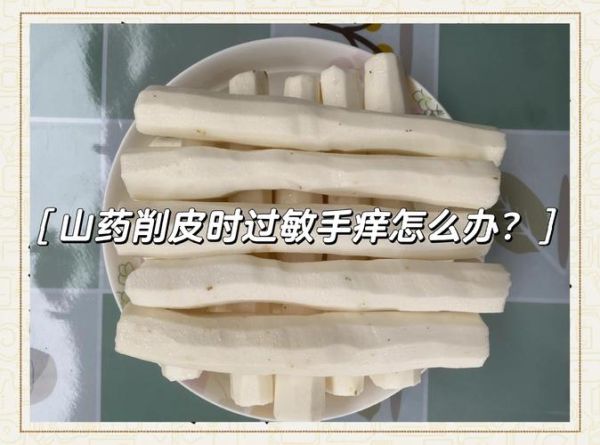 洗山药手痒能吃山药吗_山药过敏还能吃吗-第3张图片-山城妙识 洗山药手痒能吃山药吗_山药过敏还能吃吗-第3张图片-山城妙识