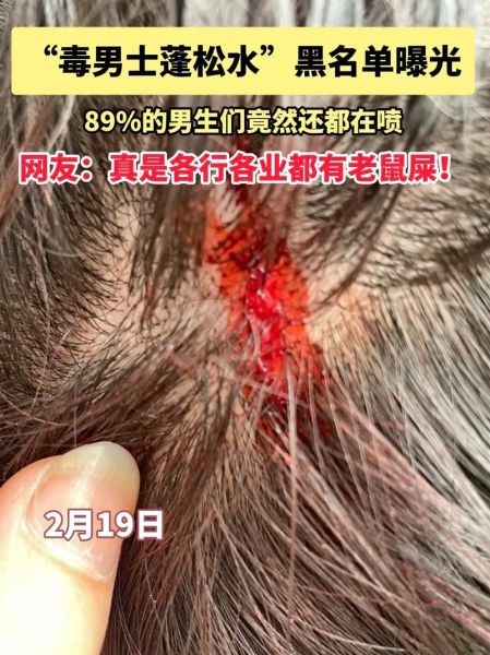 蓬灰水对人有什么危害_长期饮用会中毒吗-第2张图片-山城妙识