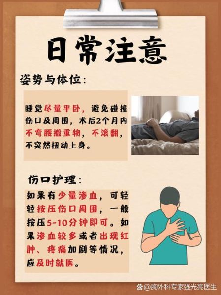 鸡胸矫正手术多少钱_鸡胸会遗传吗-第1张图片-山城妙识