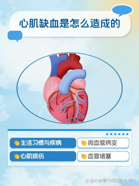 心肌缺血会自愈吗_心肌缺血能自行恢复吗-第1张图片-山城妙识