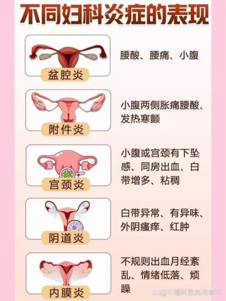 顺产9天同房了七八次_会不会感染-第3张图片-山城妙识