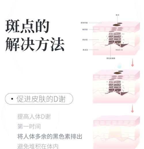用什么可以祛斑_祛斑最有效的方法是什么-第3张图片-山城妙识