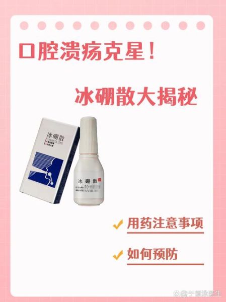 口腔溃疡吃什么药好使_口腔溃疡多久能好-第3张图片-山城妙识 口腔溃疡吃什么药好使_口腔溃疡多久能好-第3张图片-山城妙识