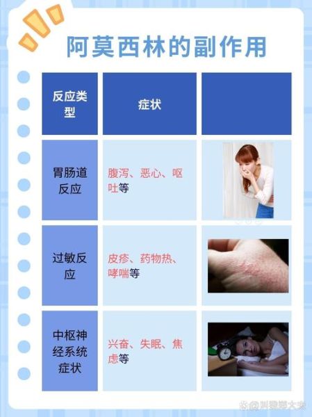 感冒发烧吃什么药退烧_成人儿童用药区别-第3张图片-山城妙识 感冒发烧吃什么药退烧_成人儿童用药区别-第3张图片-山城妙识