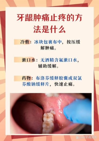 孕妇牙龈肿痛怎么办_能用什么药缓解-第2张图片-山城妙识 孕妇牙龈肿痛怎么办_能用什么药缓解-第2张图片-山城妙识