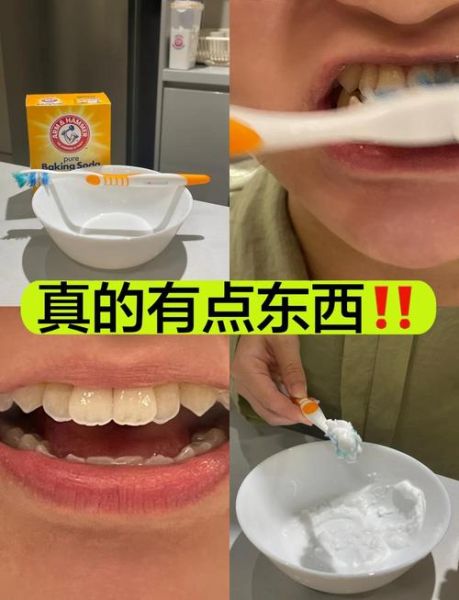 小苏打刷牙能快速美白牙齿吗_小苏打美白牙齿的真相-第1张图片-山城妙识
