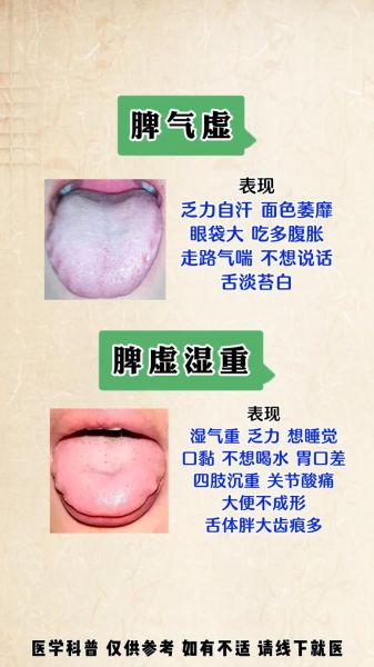 齿痕舌是脾气虚还是脾阳虚_如何区分与调理-第1张图片-山城妙识