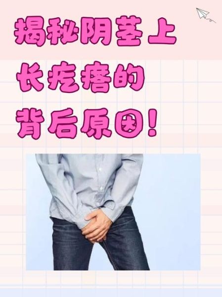 小鸡上长疙瘩了怎么回事_小鸡皮肤长疙瘩怎么办-第2张图片-山城妙识