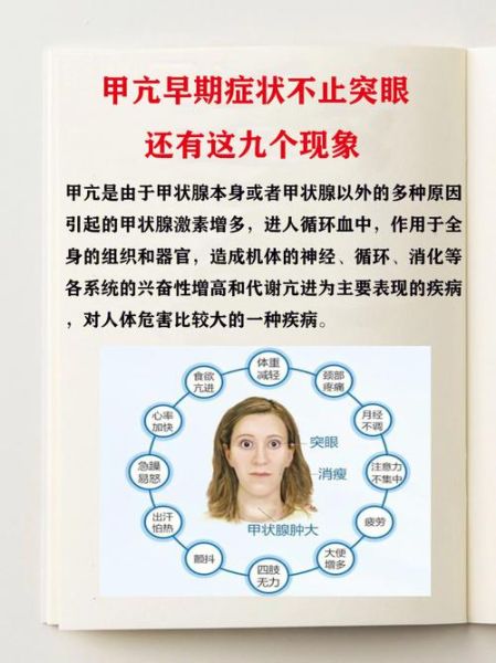 女性甲亢最明显的症状有哪些_如何判断甲亢早期信号-第3张图片-山城妙识