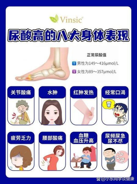 男性尿酸高有什么症状_男性尿酸高症状有哪些-第1张图片-山城妙识