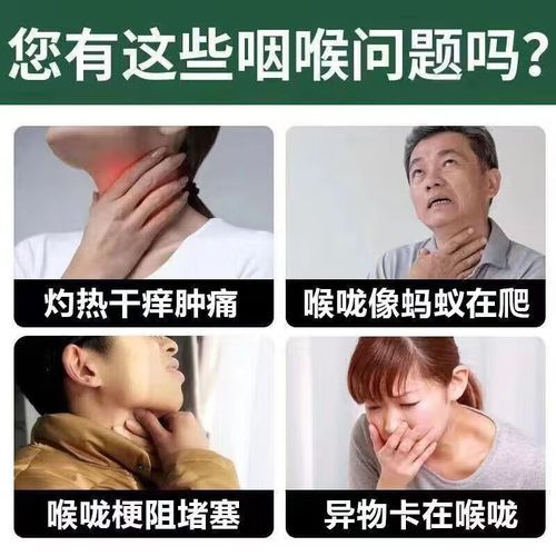 穿心莲内酯滴丸含服多久见效_穿心莲内酯滴丸含服注意事项-第2张图片-山城妙识