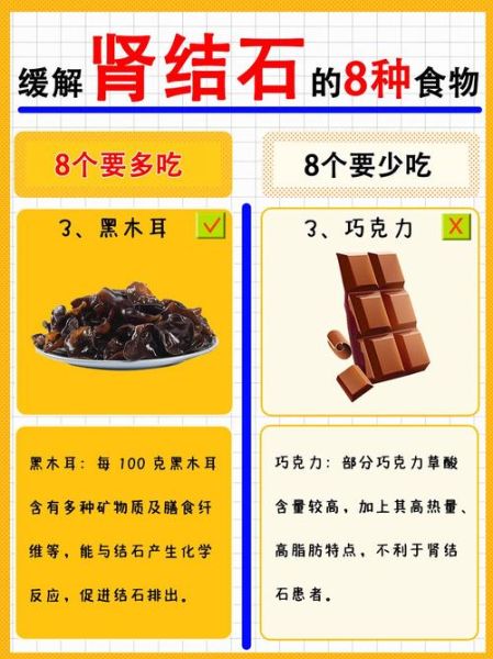肾结石饮食注意些什么_肾结石不能吃什么-第1张图片-山城妙识