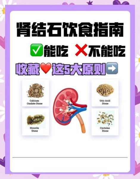 肾结石饮食注意些什么_肾结石不能吃什么-第3张图片-山城妙识