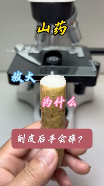 处理山药手痒怎么办_山药削皮后手痒怎么止痒-第1张图片-山城妙识 处理山药手痒怎么办_山药削皮后手痒怎么止痒-第1张图片-山城妙识