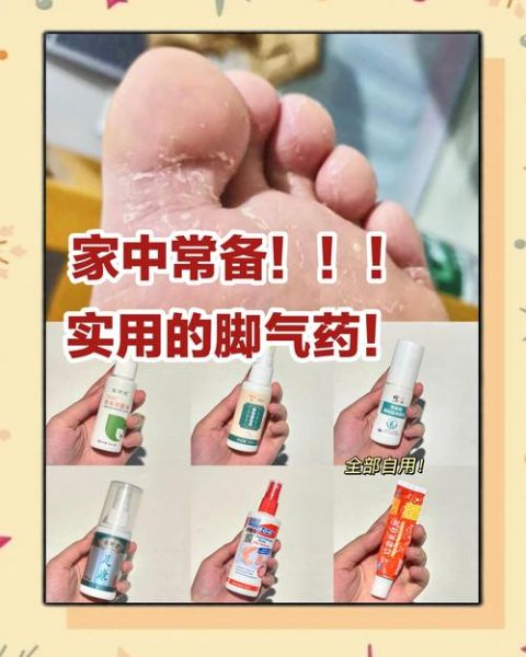 小苏打治脚气有效吗_小苏打治脚气的正确用法-第2张图片-山城妙识 小苏打治脚气有效吗_小苏打治脚气的正确用法-第2张图片-山城妙识