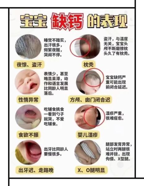 婴儿缺钙有哪些表现_宝宝缺钙怎么判断-第1张图片-山城妙识 婴儿缺钙有哪些表现_宝宝缺钙怎么判断-第1张图片-山城妙识