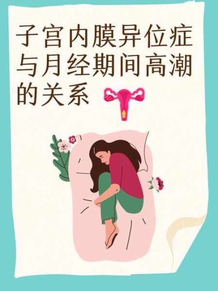 子宫内膜异位症能怀孕吗_子宫内膜异位症怎么治疗-第3张图片-山城妙识