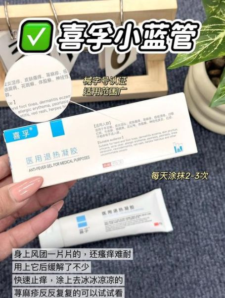 荨麻疹不管它会自愈吗_荨麻疹不治疗多久能好-第1张图片-山城妙识 荨麻疹不管它会自愈吗_荨麻疹不治疗多久能好-第1张图片-山城妙识