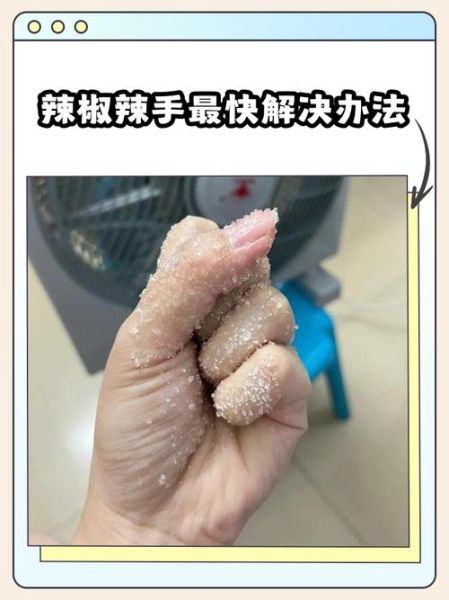 手切辣椒疼怎么办_辣椒辣手最快缓解方法-第1张图片-山城妙识